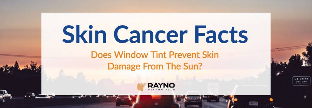 Skin Cancer Facts: Does Window Tint Prevent Skin Damage From The Sun?